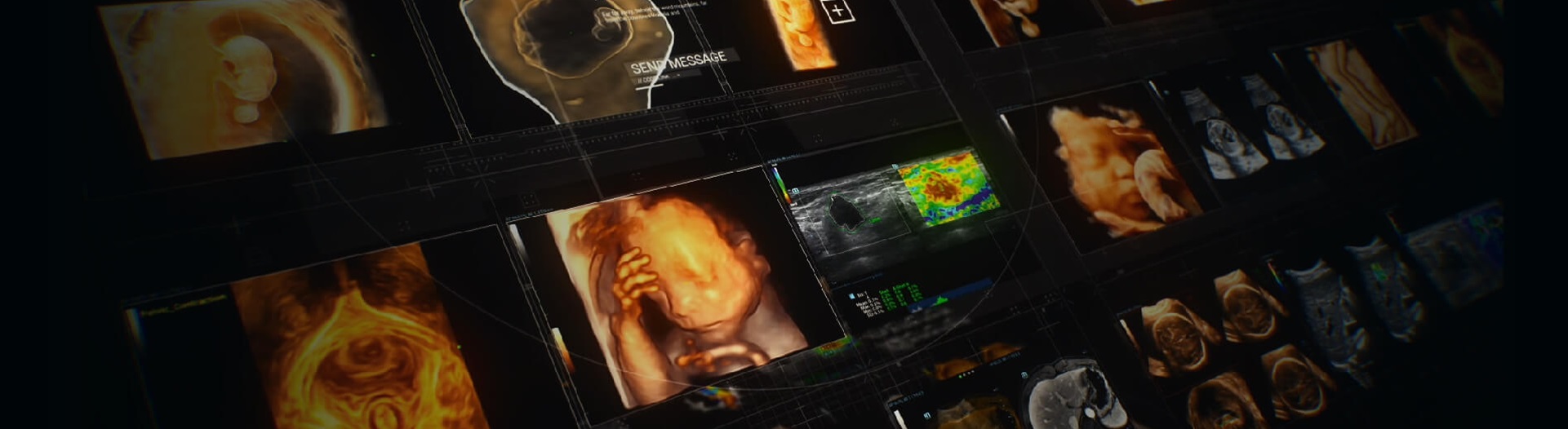 Accueil | E-learning Mindray